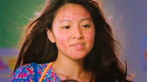 بنت وشها كله حب شباب لكن اجمل شاب في المدرسة بيحبها بس بعد عذاب👽diary