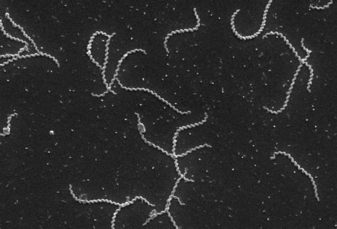 A Vaccine For Leptospirosis ELife Science Digests ELife