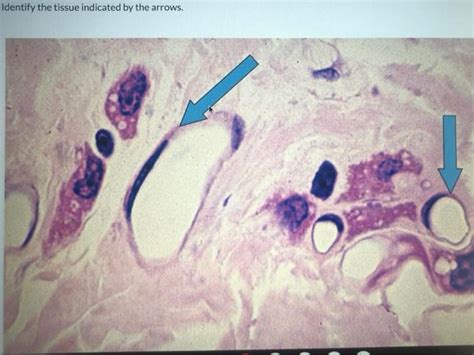 solved identify the fiber at the tip of the pointer