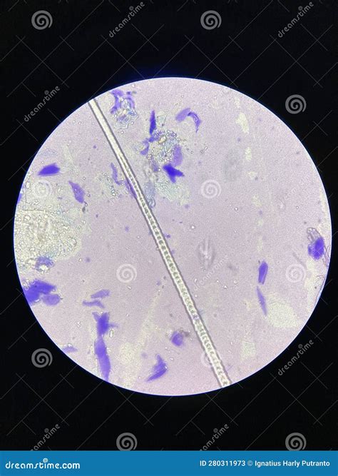 Microscopic View Of Malassezia Pachydermatis Cells Stock Image