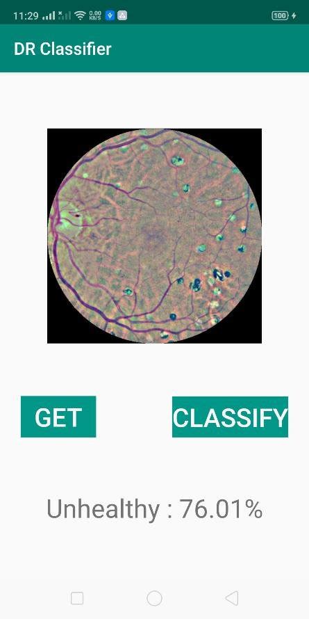12 Prediction Result Of A Smartphone Based Diabetic Retinopathy Diagnosis Download