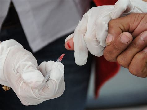 Se Duplican En Un Año Casos De Vih En Edomex Hombres Los Más Afectados