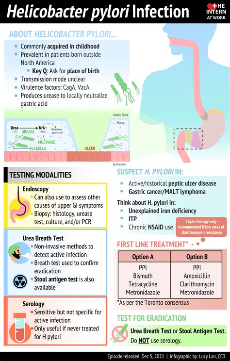 H Pylori Infection — The Intern At Work