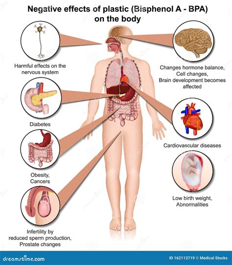 Bisphenol S Effects On The Human Body 3d Medical Vector Illustration