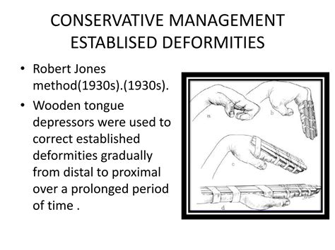 Volkmann¶s Ischemic Contracture Pptx