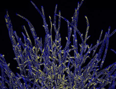 Matching Material And Cellular Timescales Enhances Cell Spreading On