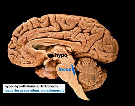 Scientists Unravel How A Tiny Region Of The Brain Helps Us Form