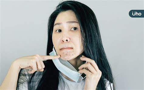 狂長「大顆痘」還有膿包？中醫揪「1體質」作祟：1茶飲有效改善uho優活健康網