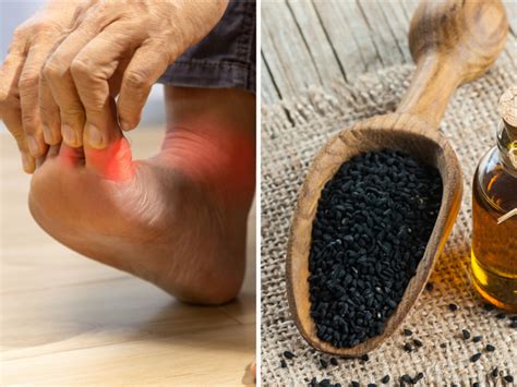 According To Dr Try These 2 Effective Home Remedies To Reduce Uric Acid