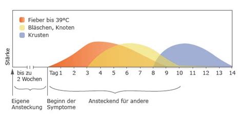 Windpocken Gesundheitsinformation De