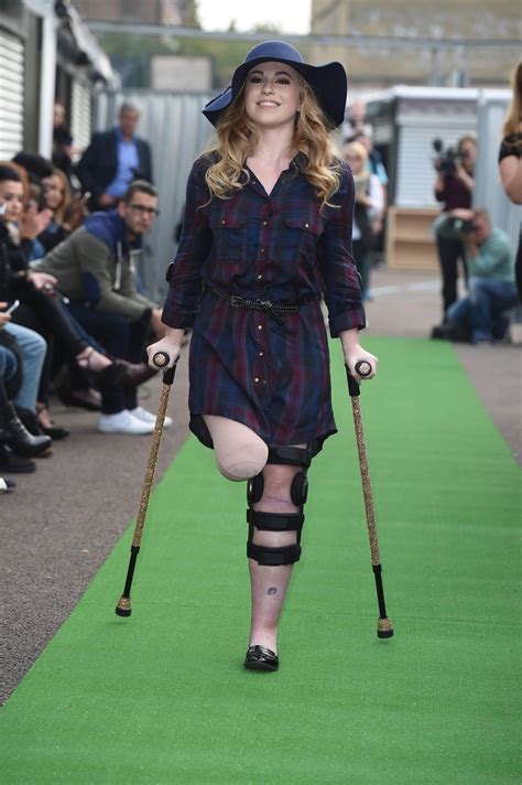A Woman Who Lost Her Leg In A Terrifying Theme Park Accident Is Now A