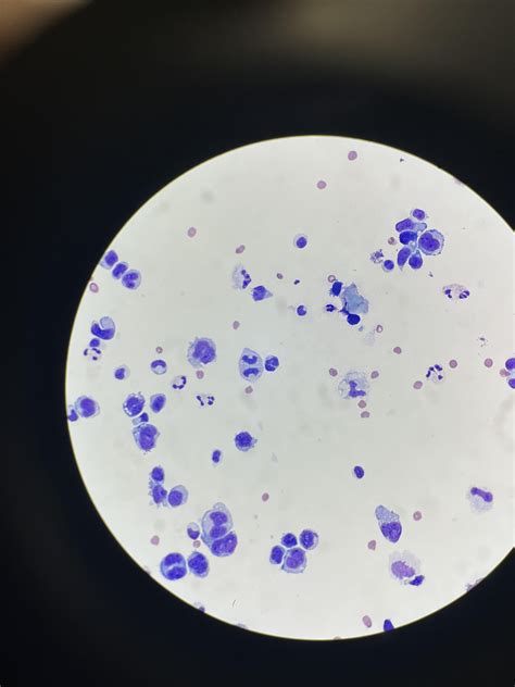 Pleural Fluid Cells Images