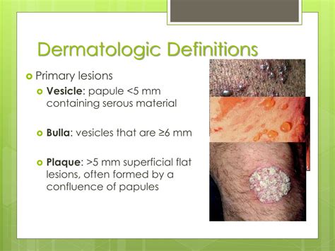 Ppt Dermatologic Conditions Of The Neonate Powerpoint Presentation