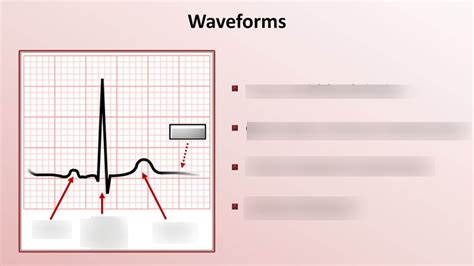 Waveform Diagram Quizlet