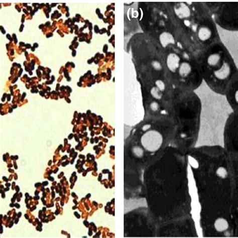 a fluorescence microscopic view exhibiting bright yellowish‐orange