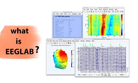 Mohammad Norizadeh Cherloo On Linkedin Eeglab Signalprocessing Eeg Matlab