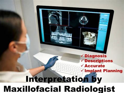 Interpretation I Annotation For Dental Radiographs 2d3d Cbct Upwork