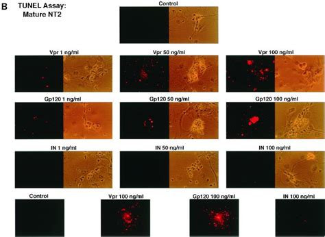 Human Immunodeficiency Virus Type 1 Vpr Induces Apoptosis In Human