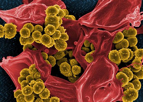 Staphylococcus Aureus Bacteria Sem Photograph By Science Source Pixels