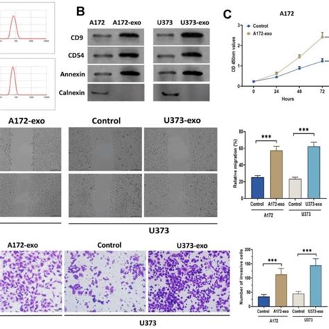 Glioma Derived Exosomes Promote Glioma Cell Proliferation And