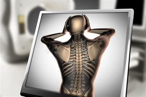 Human Bones Radiography Scan Image Stock Illustration Illustration Of