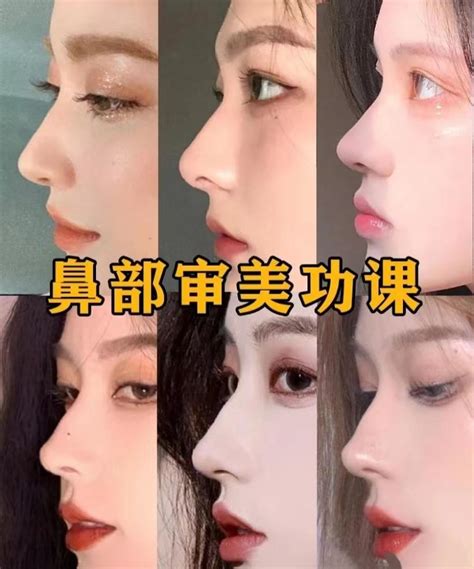 成都哪家医院做隆鼻比较好成都优选隆鼻人气机构成都隆鼻医生排名含排名价格反馈资质 知乎