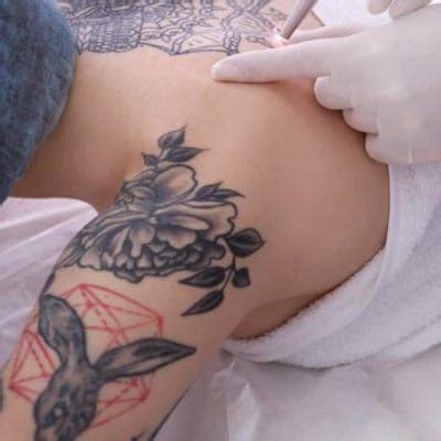 Hoe Werkt Tattoo Laseren Izzi Laser Clinic Gratis Intake