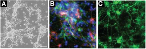 Neural Progenitor Cells Isolated From Adult Mouse Brain Express Neural