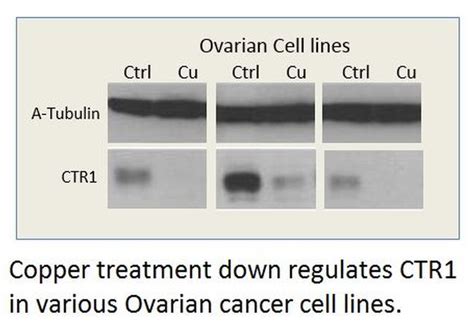 CTR1/SLC31A1 Polyclonal Antibody (CTR1-101AP)