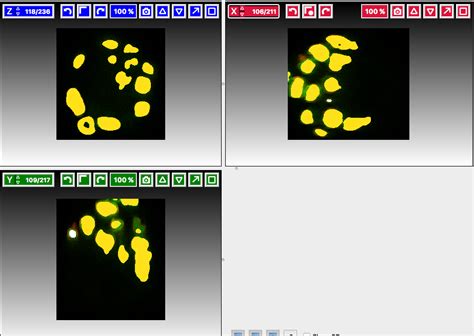 Use Ilastik As A Fiji Plugin And Omero — Omero Ilastik Guide 034dev0
