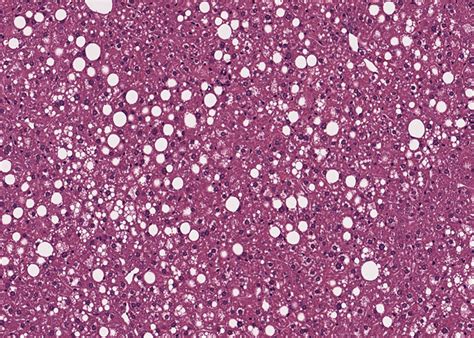 Histology Services Gubra