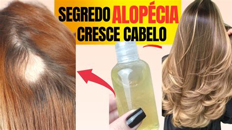MELHOR RECEITA CASEIRA PARA QUEDA DE CABELO E CURA ATÉ ALOPÉCIA