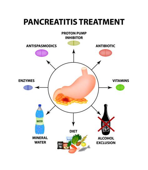 Top Pancreatitis Clip Art Vector Graphics And Illustrations Istock