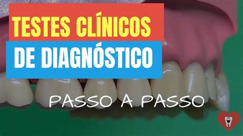 Testes ClÍnicos Endodontia Passo A Passo Youtube