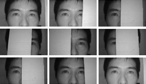 Video Dataset Based On Automated Cover Tests For Strabismus Evaluation