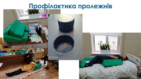 Пролежні та трофічні ураження шкіри у паліативних пацієнтів сучасні