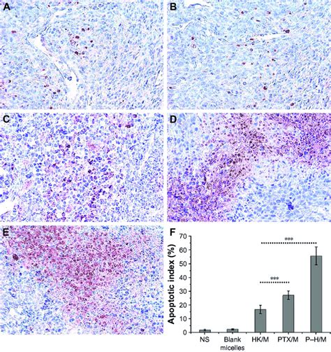 Representative Tunel Staining Of Tumors Notes The Pictures Of Tunel