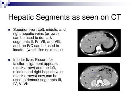 Ppt Ct Of The Hepatobiliary System And Pancreas Powerpoint