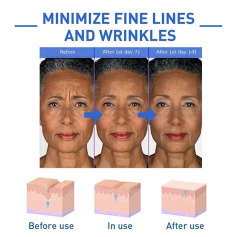 Last Day Promotion 70 Off 🔥botox Face Serum