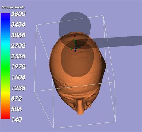 Motor Cortex Mapping Results Based On Laser Scans Download
