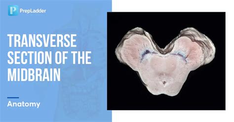 Transverse Section Of The Midbrain