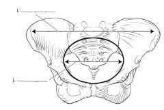 A P Lab Appendicular Skeleton Lower Flashcards Cram Com