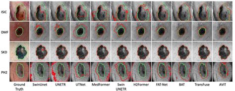 Visual Comparison With Different Sota Methods The Green Contours Are Download Scientific