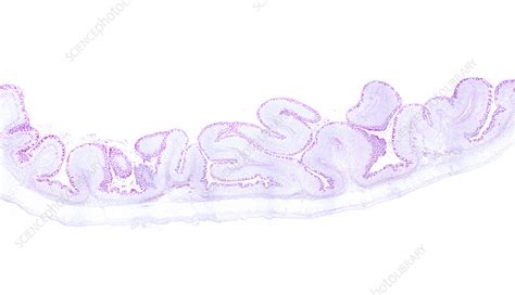 Stomach Light Micrograph Stock Image C0563720 Science Photo Library