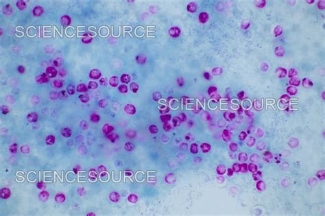 Cryptosporidium Parvum Microscope
