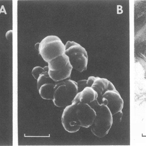Electron Micrographs Of The Penicillin Sensitive Wild Type And