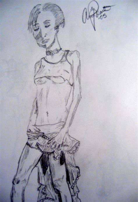 Anorexic By Alexpuckett On Deviantart
