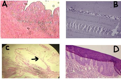 Common Artifacts And Remedies In Histological Preparations