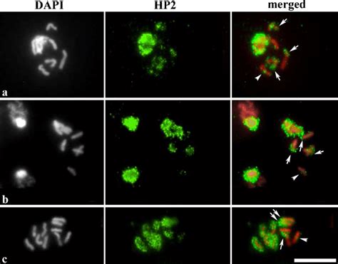 Hp2 Antibody Pattern In Mitotic Male Cells Left Dapi Staining