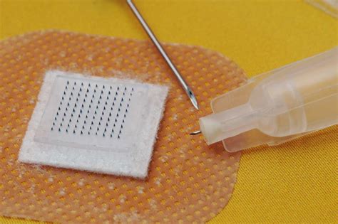New Flexible Microneedle Patch Promises Faster Medication Delivery